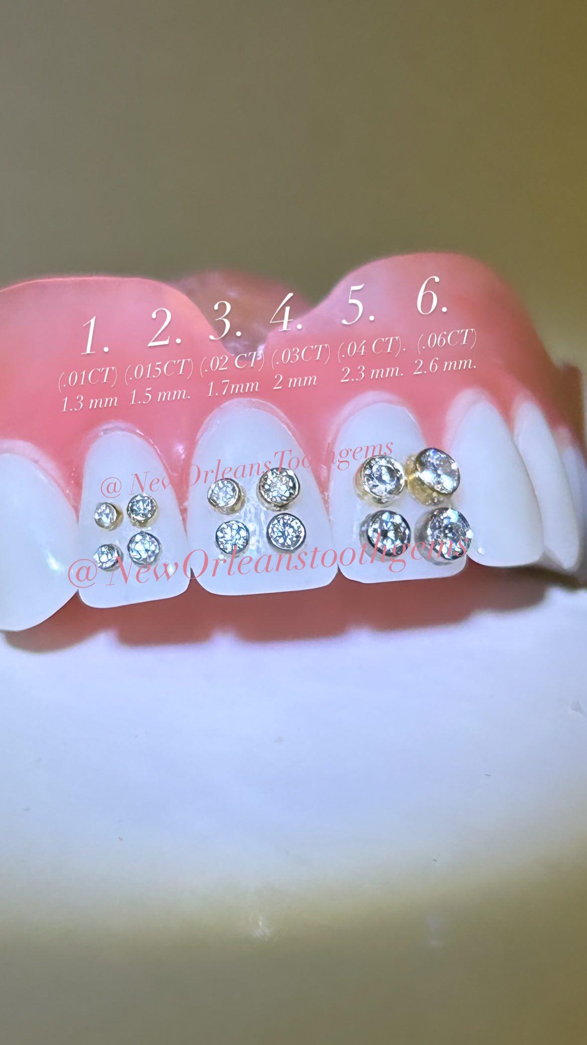 Diamonds – New Orleans Tooth Gems Www.goldtoothcharms.com